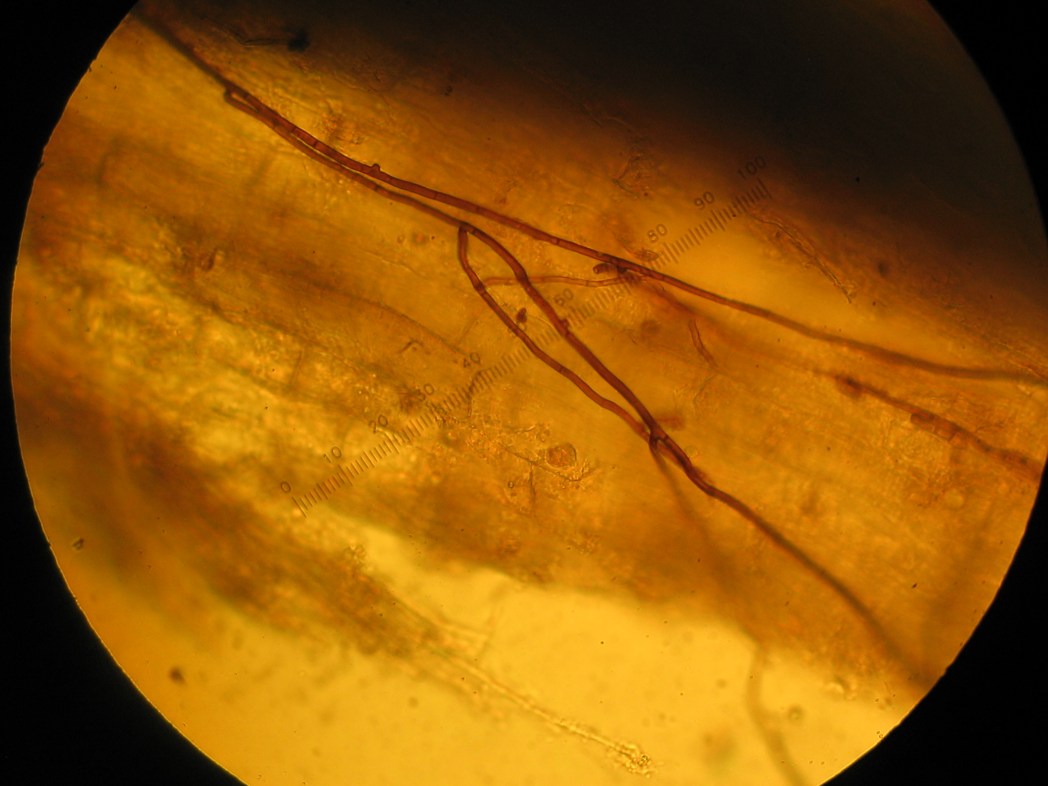What Is Brown Patch in Turf? How to Identify It? - Article