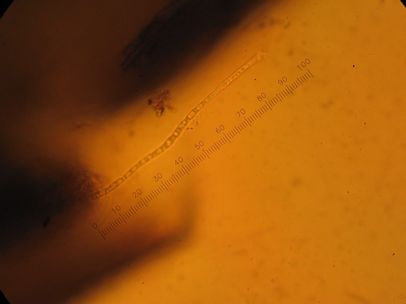 What is Dollar Spot? How to Identify It? - Article