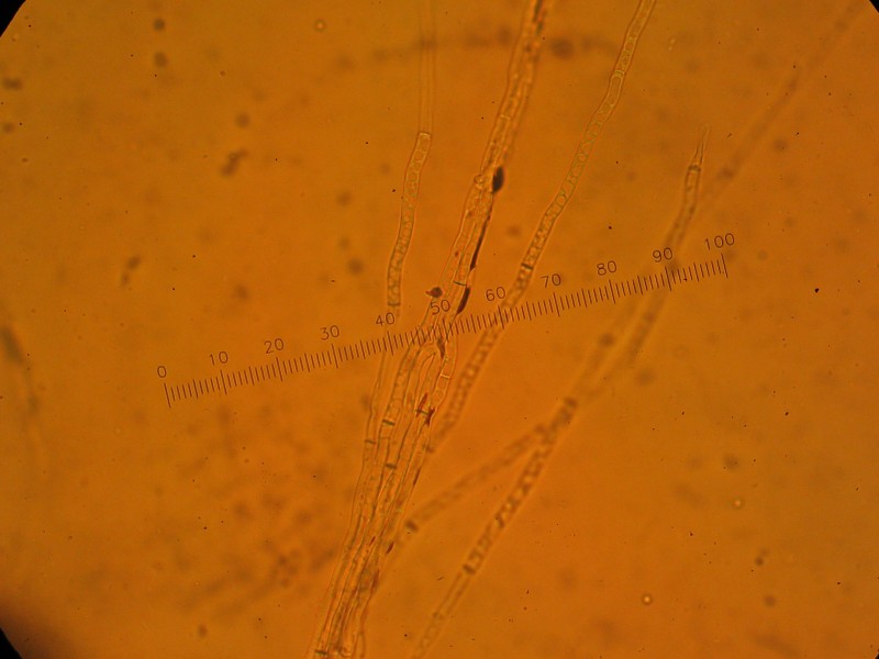 What is Dollar Spot? How to Identify It? - Article