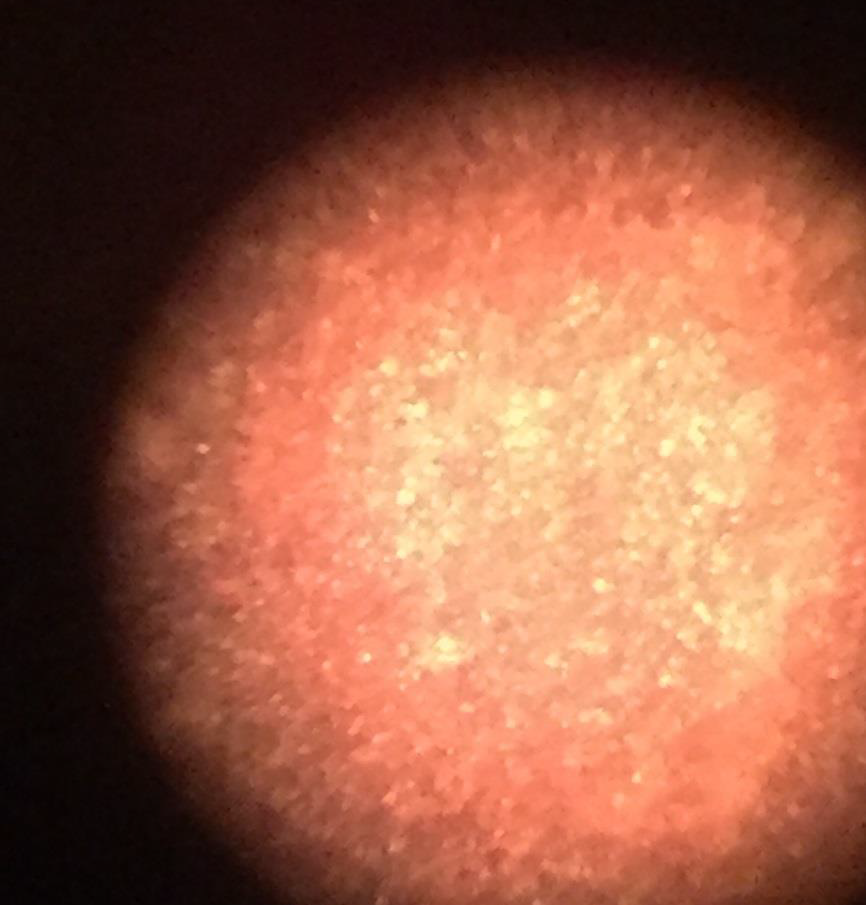 How to Identify, Diagnose Damage & Manage Ground Pearl in Lawns and ...